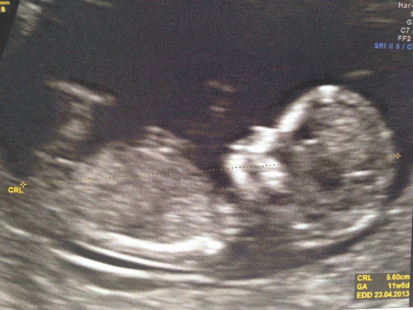 Breathe Gently - by Mamajags: March 2013