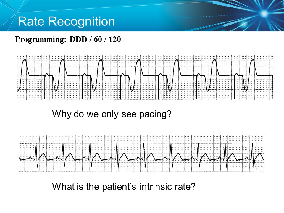 CVT Mohd Farid: Pacemaker Follow Up Part I-Medtronic Academy