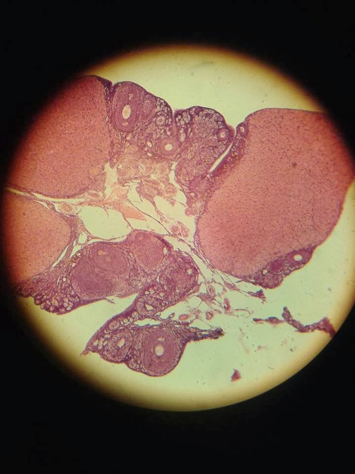 Blog de Embriología 1PM1 : La gametogénesis y una embarradita de ...
