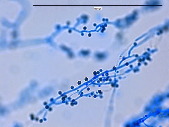 Fun With Microbiology (What's Buggin' You?): Sporothrix schenckii ...