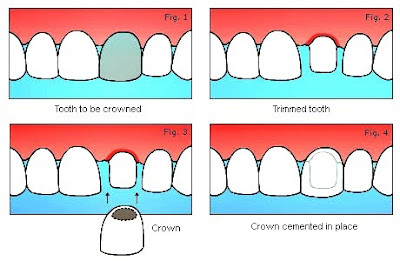 EYJA HEBAT: Crowning Gigi