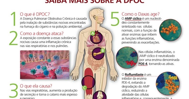 Fui na Coletiva: DPOC - Você sabe o que é isso?