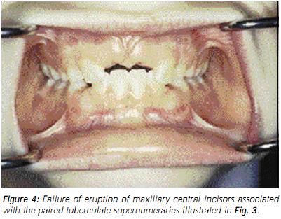 Dentistry lectures for MFDS/MJDF/NBDE/ORE: A Note On Classification ...