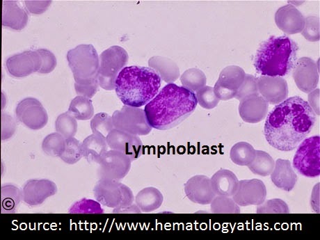 Lab Atlas: Lymphoblast