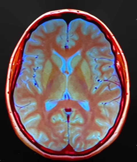 Nevit's blog: 2014/04 - 2014/05