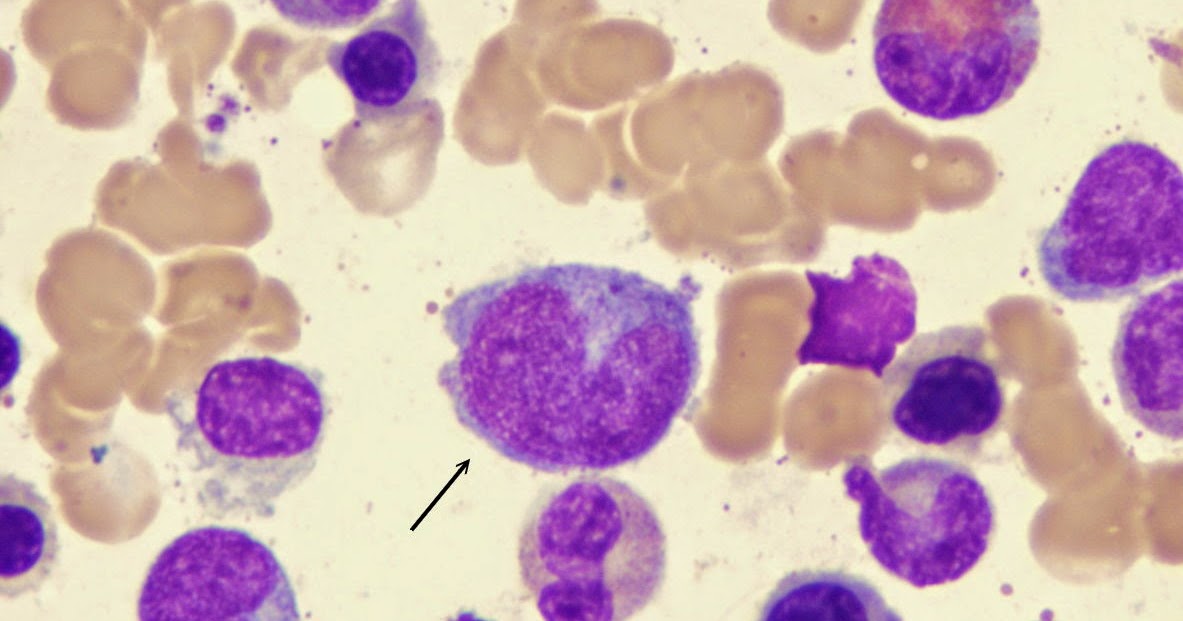 Fichero de Hematología Heber Mayén: Promonocito