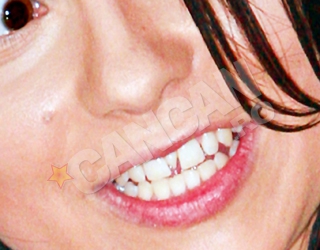 Stillglamo.ro: Inna avea un dinte în plus înainte să fie celebră!