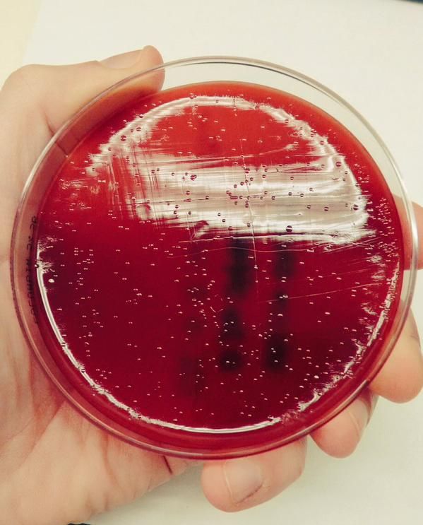Helicobacter pylori - Microbiology Laboratory Turkey