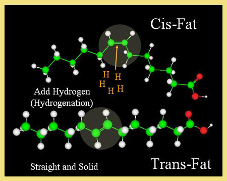 "ට්‍රාන්ස් ෆැටි ඇසිඩ්" මරුවා ගැන දැනගන්න | "Trans fatty acid" the ...