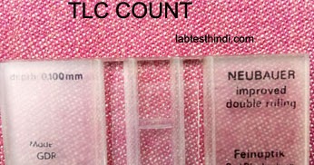 TLC( total leukocyte count) Test कैसे करते है ~ Lab Test Hindi