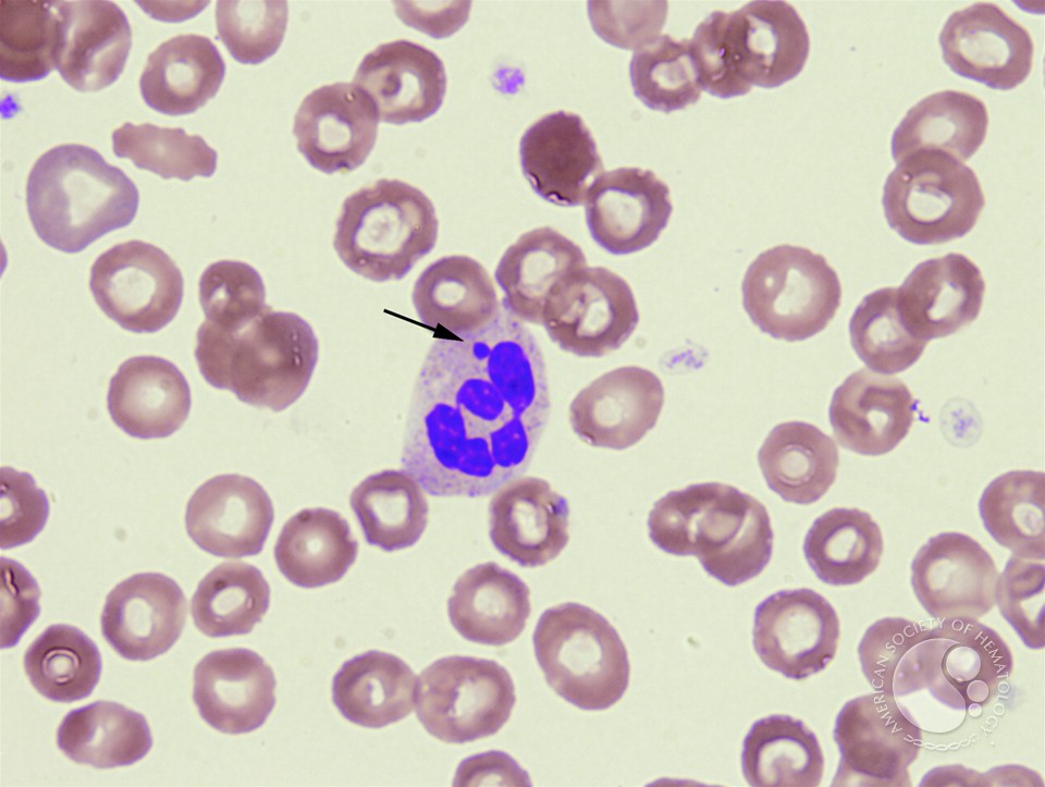 Salisbury's Graduate Histology: Blood