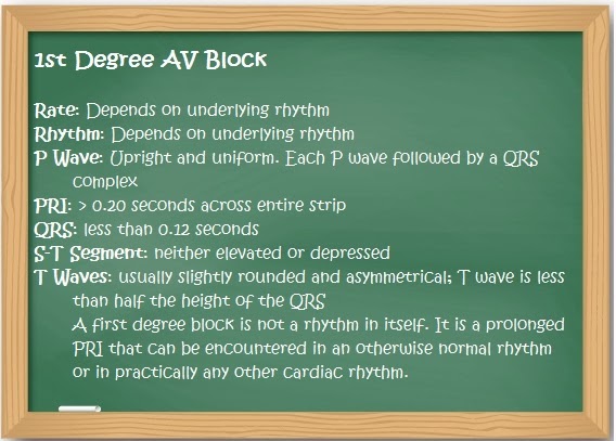Basic Rhythm Review: Heart Blocks