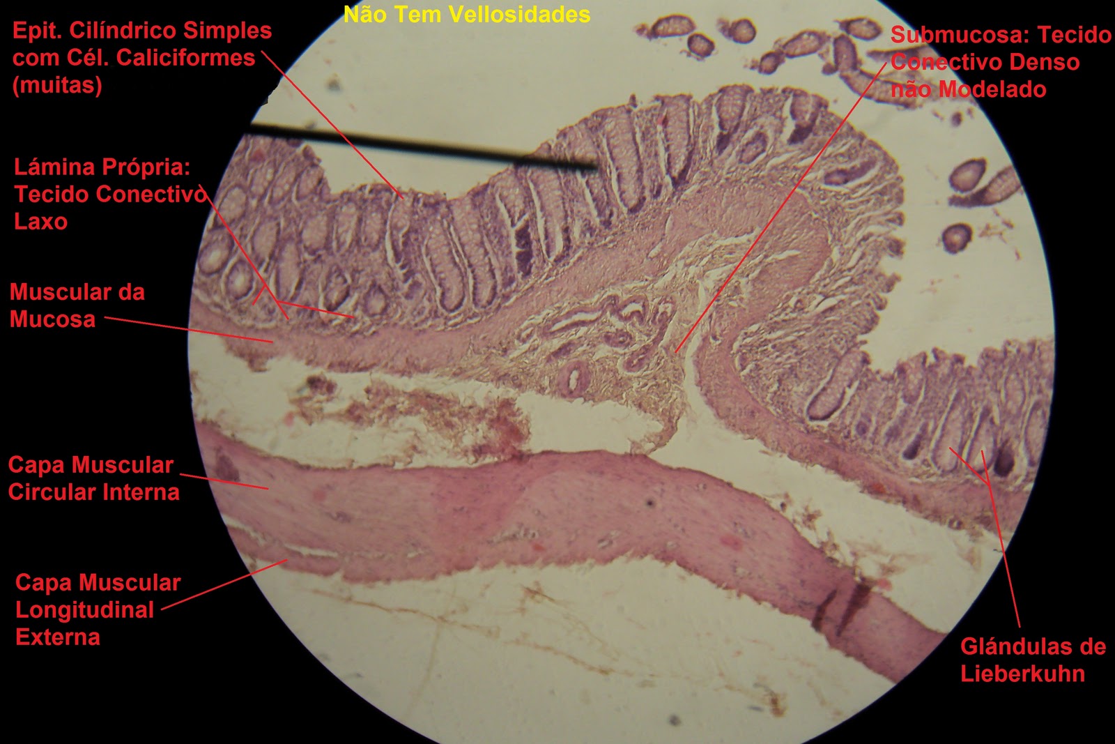 Plantão Médico: Histología del Aparato Digestivo Parte - 2