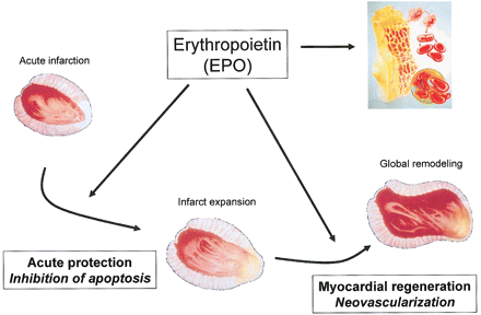 Erythropoietin (EPO) and EPO Test - Ain Health