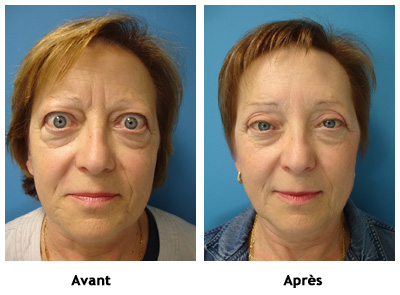 Ambulance Taysir Tunisia ... الإسعاف الطبي تيسير: HYPERTHYROÏDIES