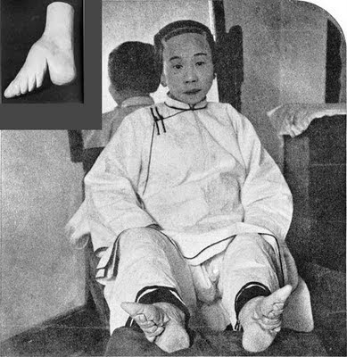 Worldly slice: Chinese Lotus Feet