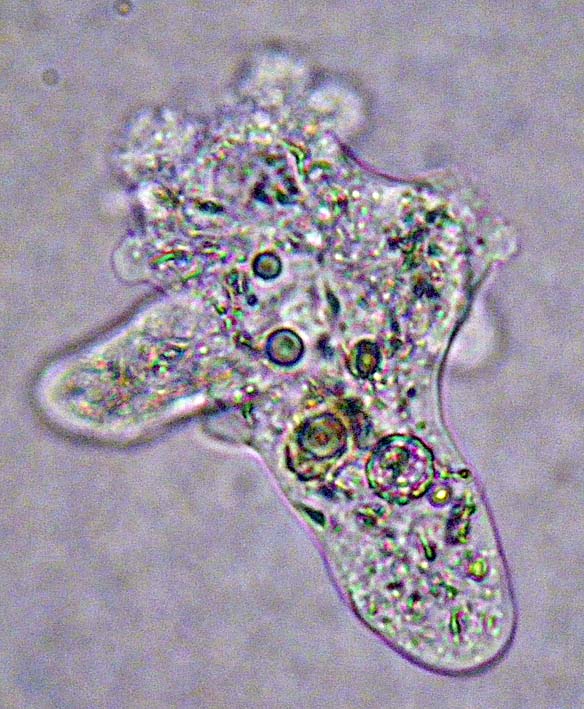 Beyond the Human Eye: Life in 10 Drops of Water: Assorted Protists and ...