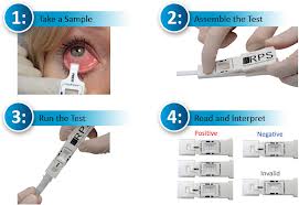 MEDICO-OCULISTA EN ESTEPONA: ADENOPLUS Y INFLAMMADRY