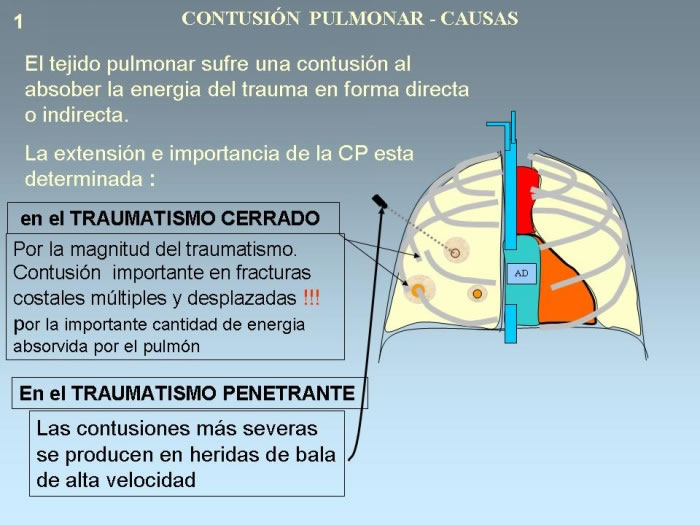 Dra.Yanis Valdez: El TÓRAX