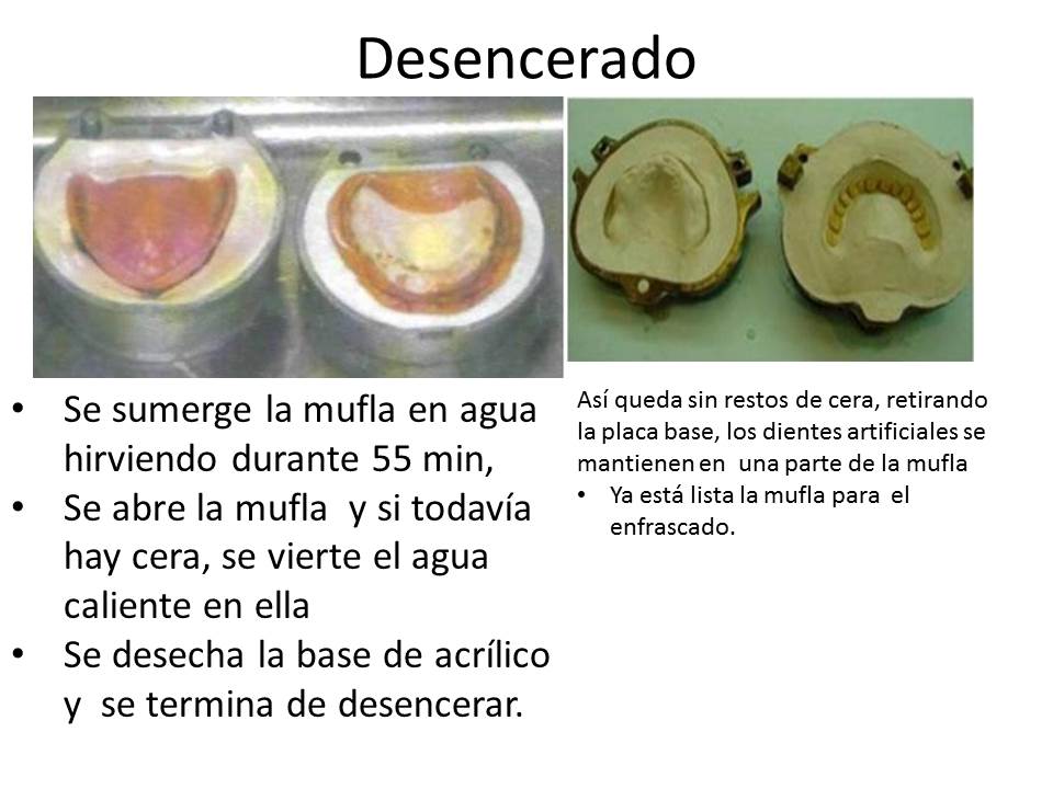 Verano Rehabilitación III: Continuación del 2° Parcial Placa Monomaxilar