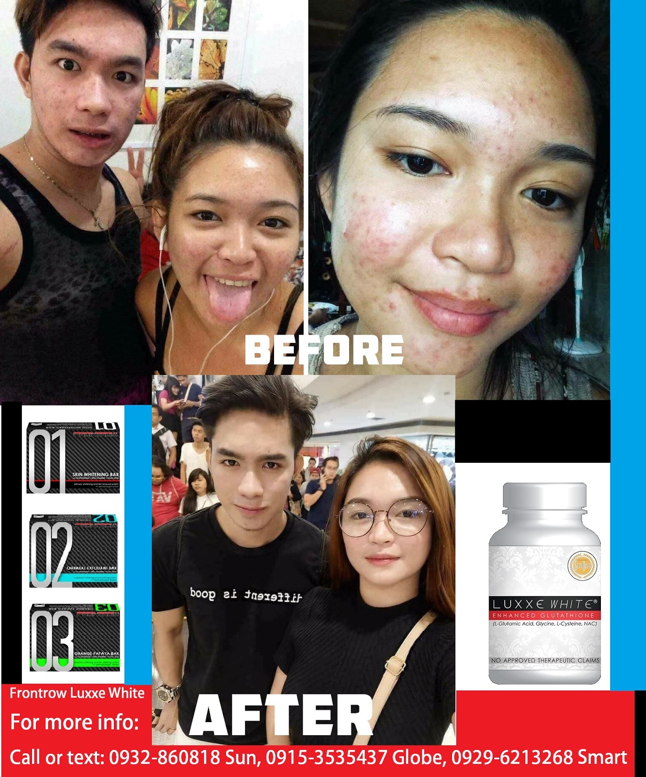 Frontrow Luxxe product before and after use