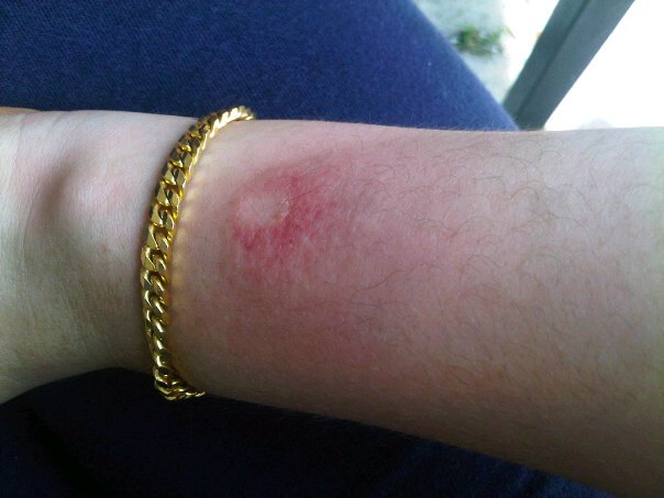 The Chronicals of a Married Woman: Pain Ball