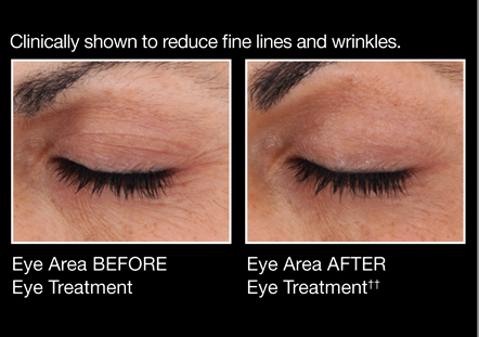 The Life Challenge: Avon Anew Genics Eye Treatment Cream Reviews