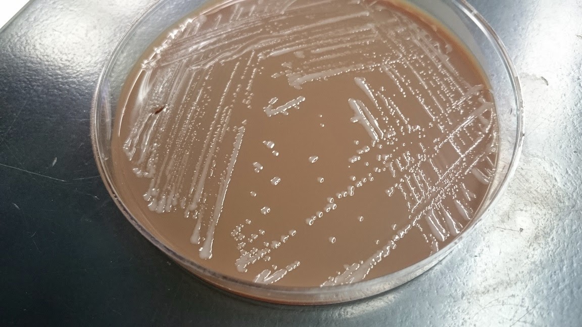 osama`s notebook: Extraction of Genomic DNA from Francisella tularensis ...