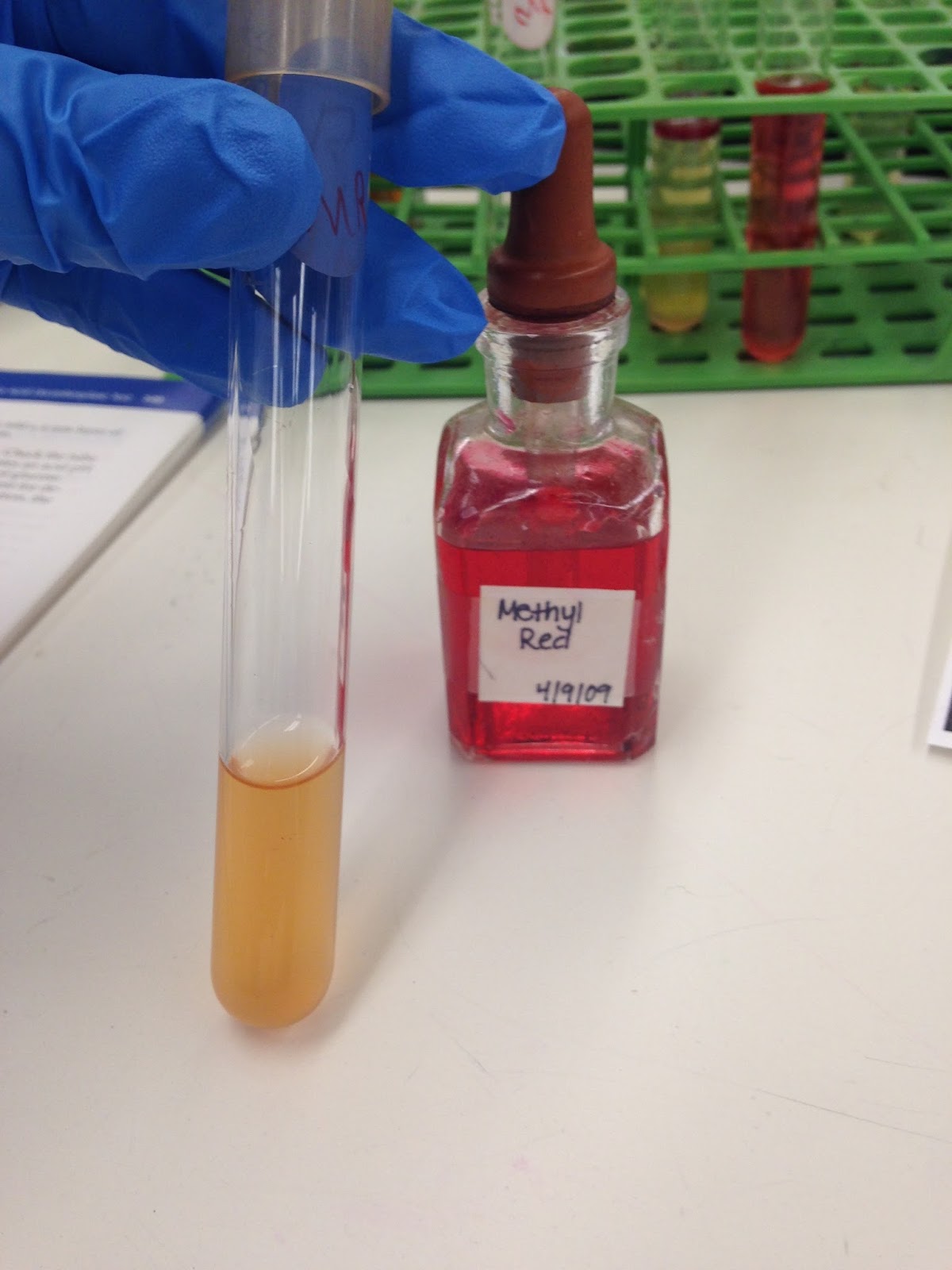 Microbiology Mania Imvic Tests Indole Methyl Red Voges Prokauer And Citrate Utilization