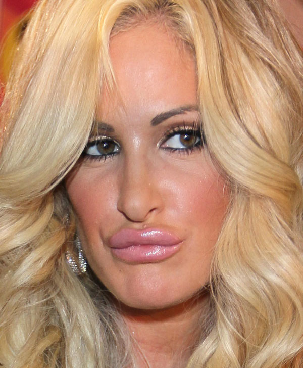 Chatter Busy Kim Zolciak Plastic Surgery