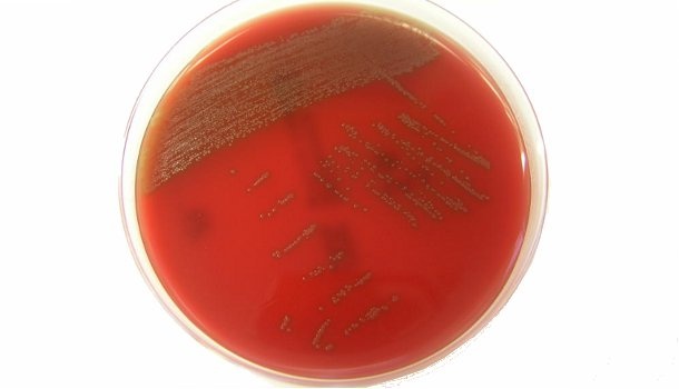 Une bactérie sur les muqueuses buccales pourrait provoquer des maladies ...