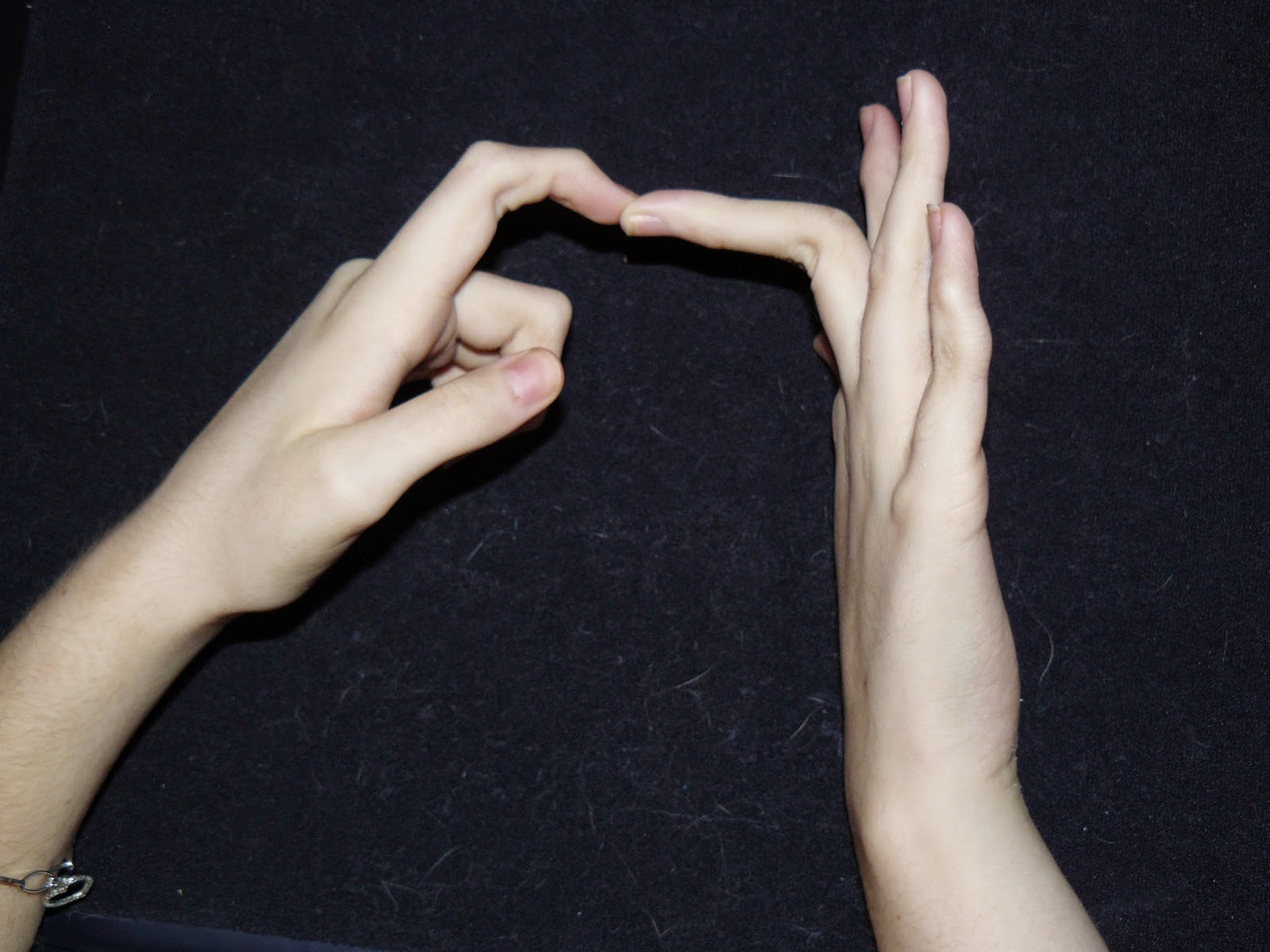 Ehlers-Danlos Syndrome: Are You Aware? – Lucy Watts MBE / Lucy Watts Ltd