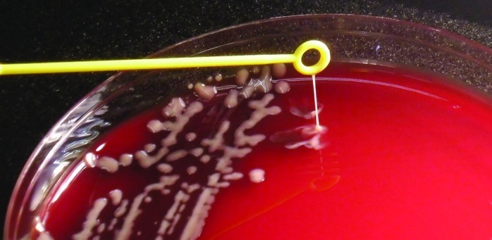 Medical Microbiology: September 2017