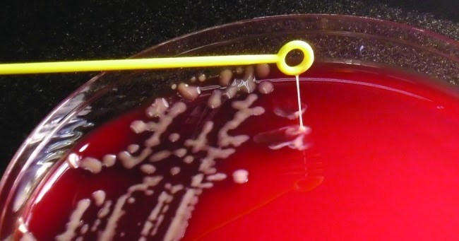 Hypervirulent Klebsiella pneumoniae
