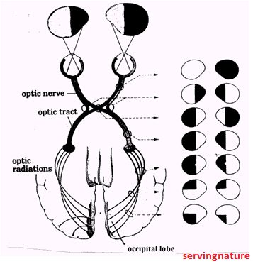 Healthy Body-Healthy Mind: Visual Field Determination