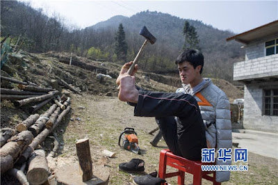 Meet The SUCCESSFUL Man Born Without Arms But Can Do Virtually ...