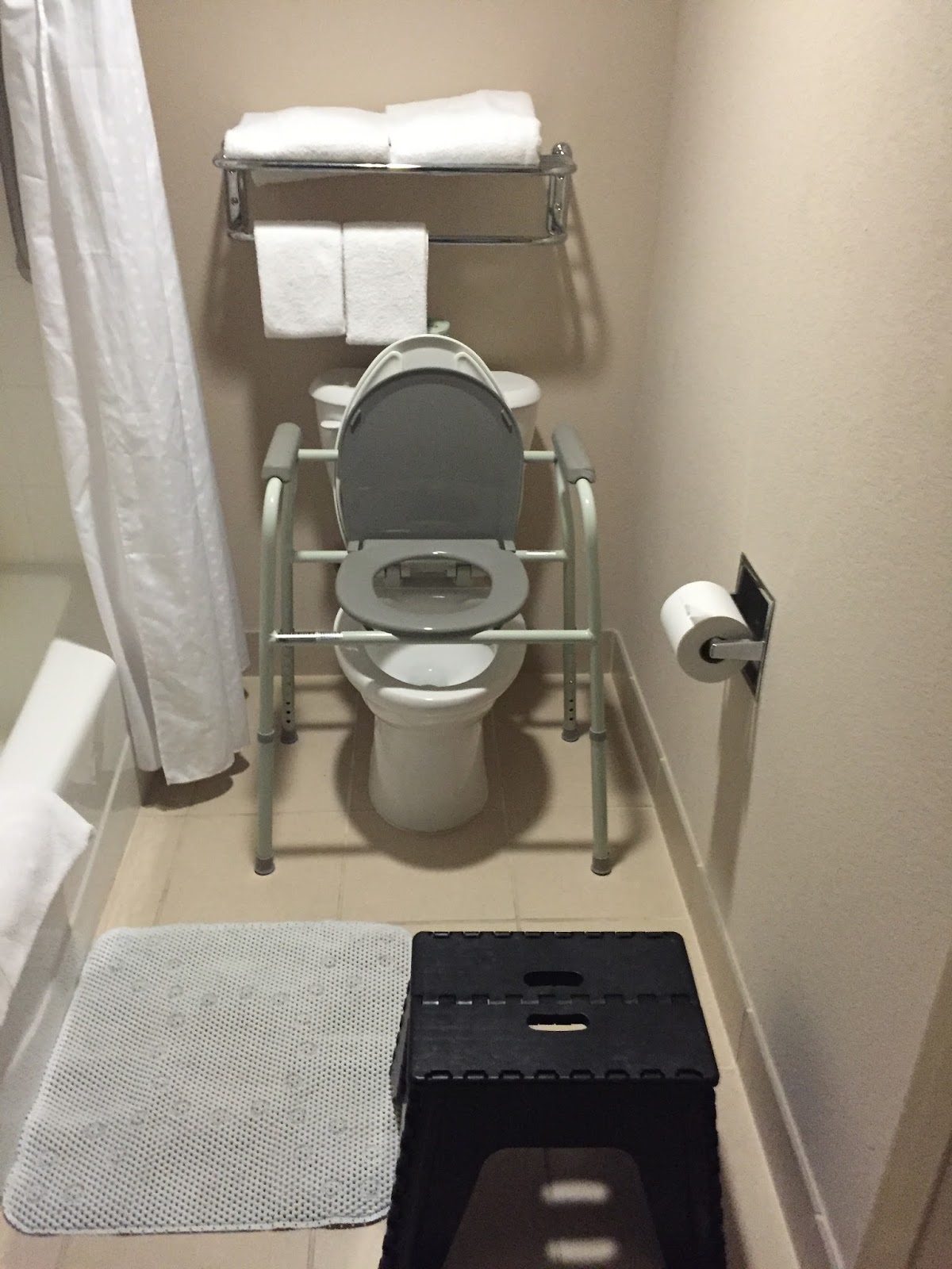 Megan's ACI Carticel Surgery: Preparing for ACI Surgery Part II