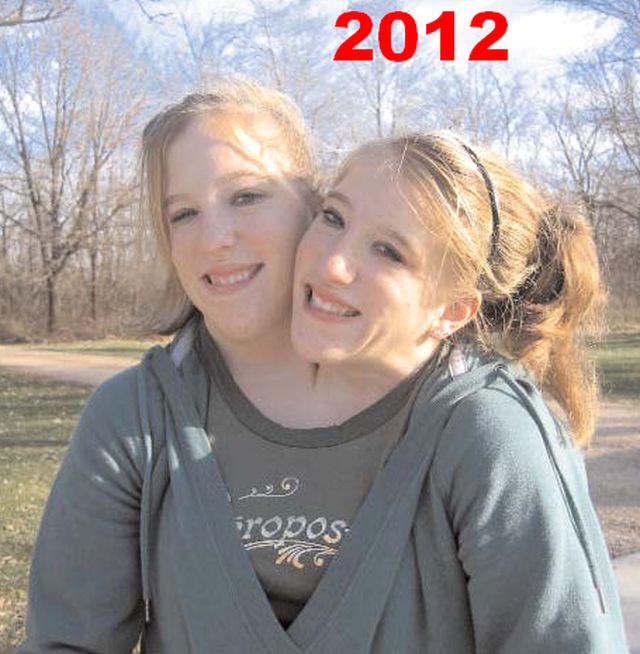 10 MINUTOS NOTICIAS: Chica de 2 Cabezas