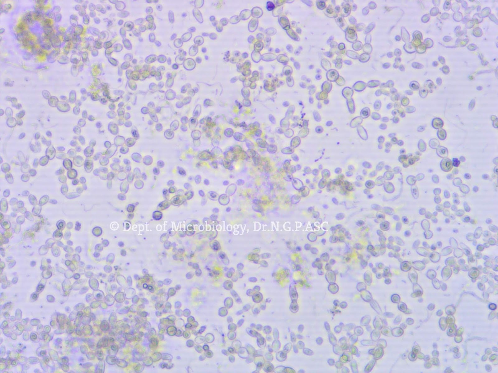 SENTHIL PRABHU SIVASAMY: Observation of Yeast (Baker's Yeast) Cell ...