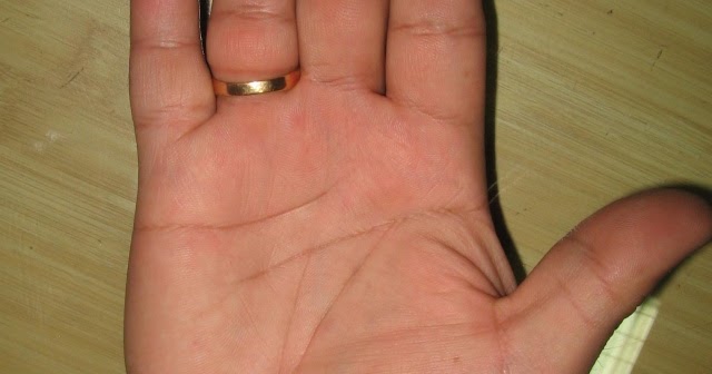 Short Little Finger (Pinky Finger) On Hand In Palmistry ~ INDIAN ...