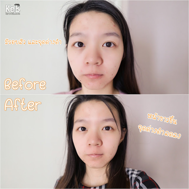 Review :: สบู่โบลาเต้ Bolate ผิวกระจ่างใสด้วยสารสกัดจากธรรมชาติ 100%