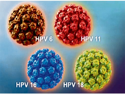 Tratamiento para el VPH: Tipos de VPH