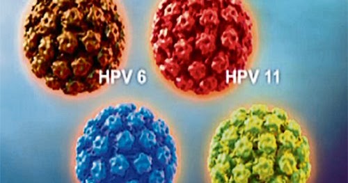 Tratamiento para el VPH: Tipos de VPH