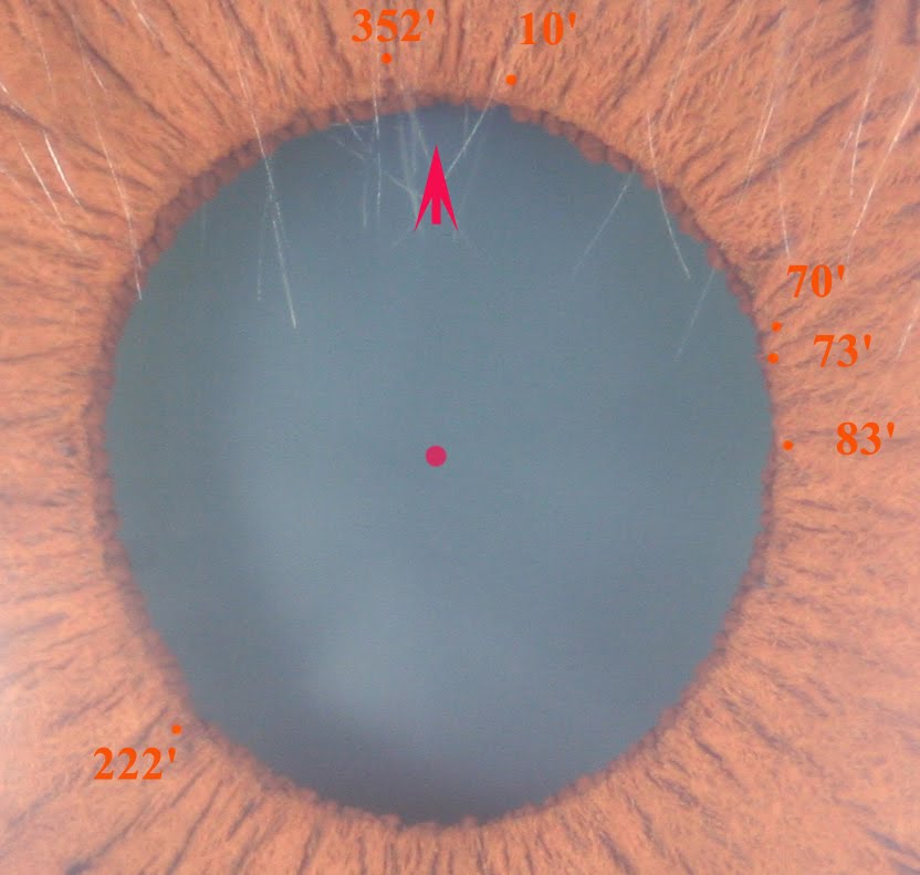 Modern & Multidimensional Iridology: Multidimensional Iridology ...