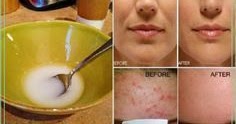 HOW TO WASH YOUR FACE AND SAY GOODBYE TO SAGGY FACIAL SKIN AND WRINKLES ...