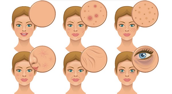 DESCUBRA EL TIPO DE CUTIS SEGUN LO QUE USTED COME Y BEBE SE SORPRENDERÁ ...