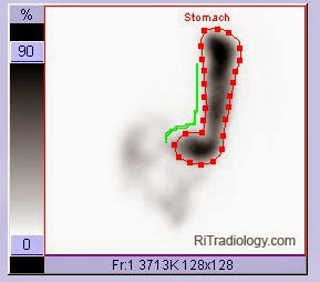 RiT radiology: Gastric Emptying Scintigraphy: SNM Recommendation
