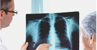 Abses Paru-Paru (Lung abscess)