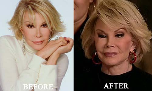 Mama pidgin: See Wetin Plastic Surgery Turn this People into, Plastic ...