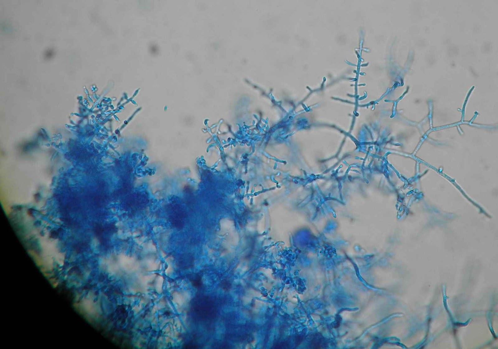 ATLAS MICOLOGIA: TRICHODERMA species